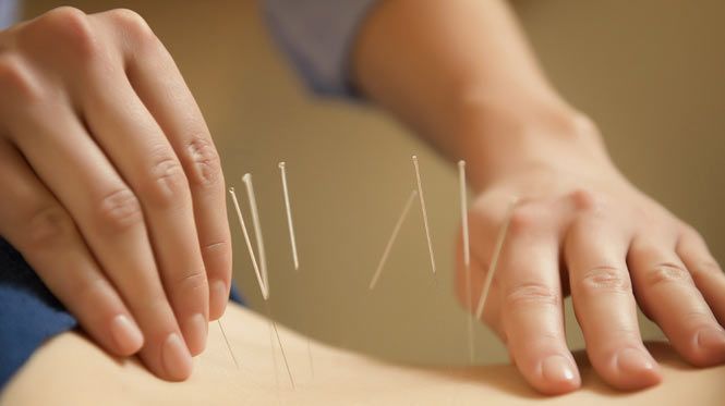 Acupuncture Treatment | Annex Naturopathic Clinic | Toronto Acupuncture Treatment | Annex Naturopathic Clinic | Toronto